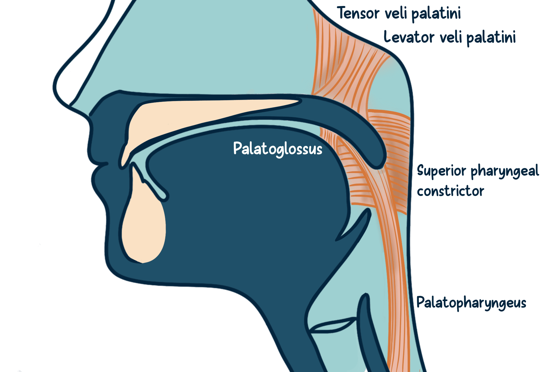 The structural 'why' behind the VPI